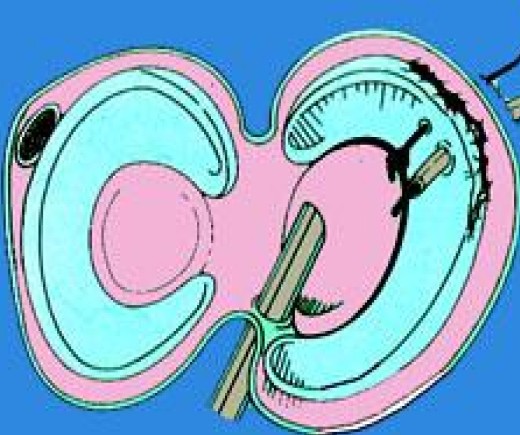 Les ménisques | Chirurgie du genou | Chirurgien orthopédiste Cavaillon